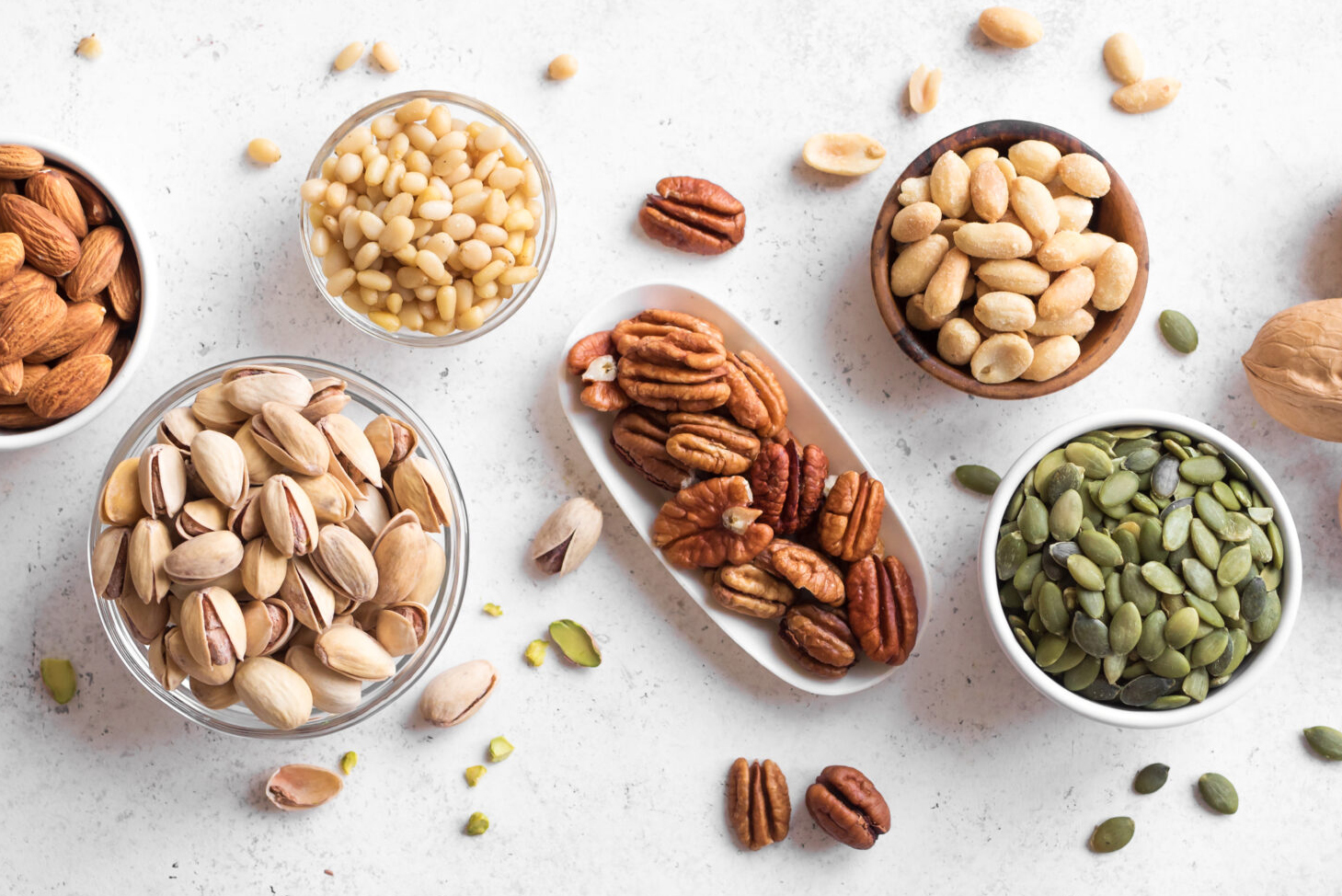 Introducing a new rapid test: OnSite® Allergen Multiplex Tree Nut ...